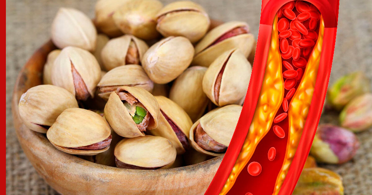 Ученые назвали вкусное средство от высокого холестерина